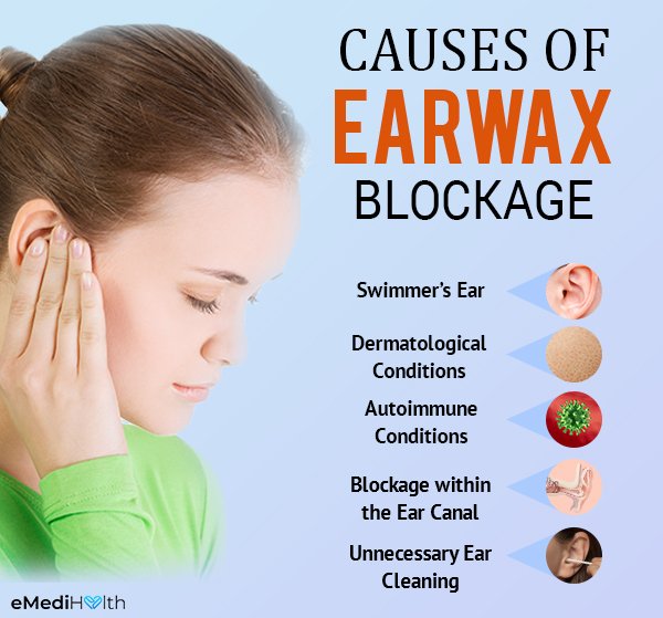 Common Causes Of Earwax Build-up - Ask The Nurse Expert