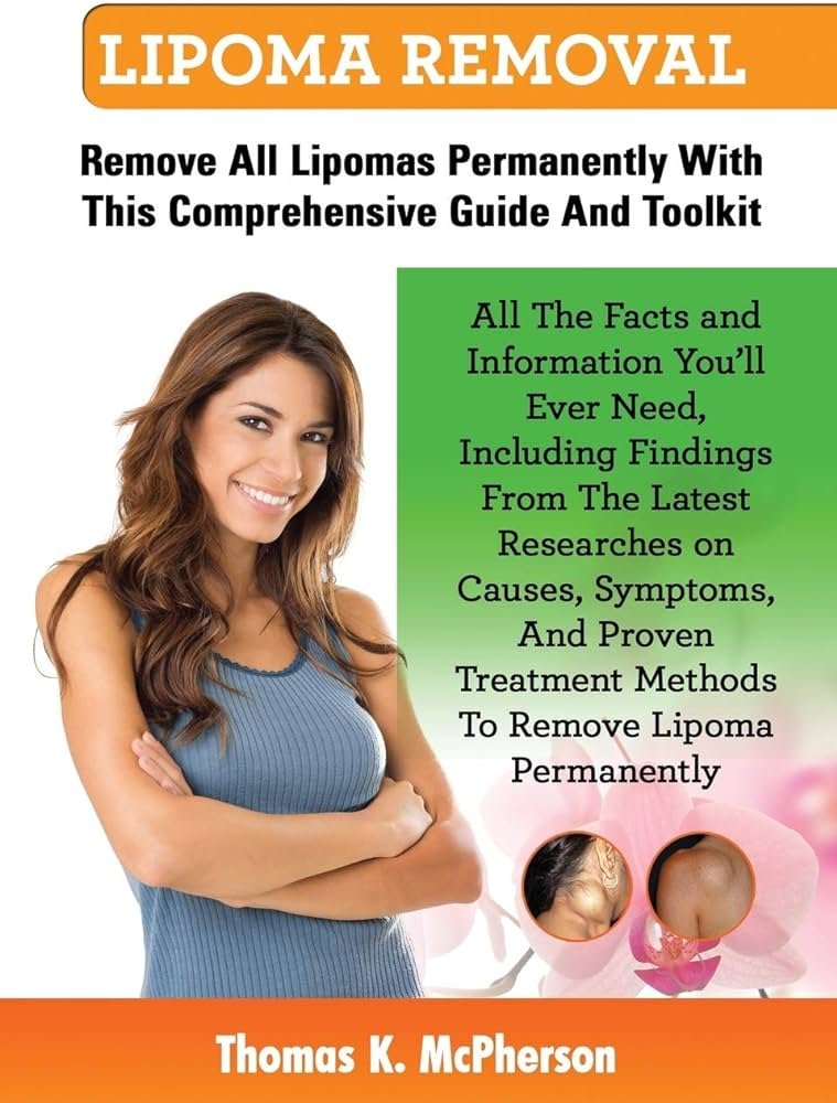 Exploring Lipoma: What You Need To Know - Ask The Nurse Expert
