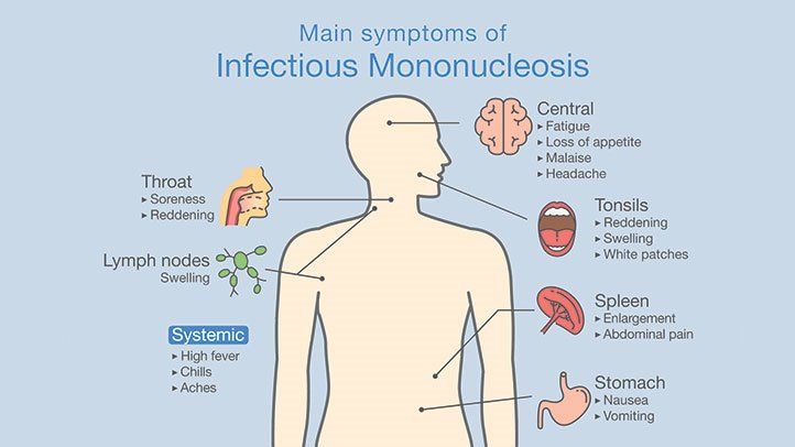 Exploring The Various Complications Of Mononucleosis - Ask The Nurse Expert