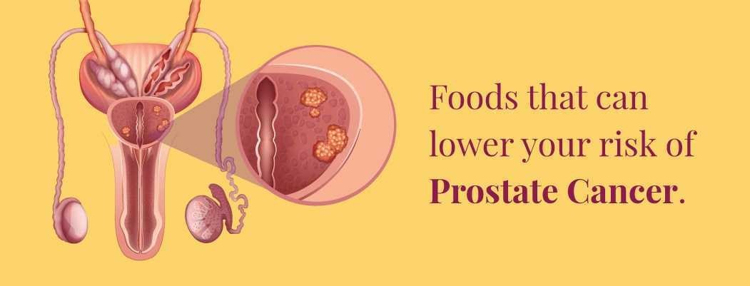 How To Prevent Prostate Cancer - Ask The Nurse Expert