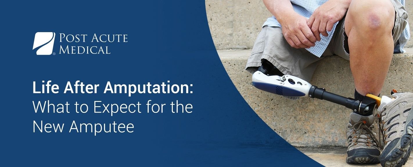 Living A Fulfilling Life After Amputation - Ask The Nurse Expert