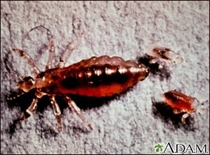 Louse Borne Relapsing Fever: An Emerging Public Health Concern - Ask ...