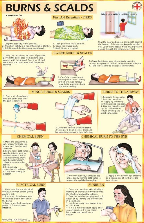 Preventing And Treating Burns At Home - Ask The Nurse Expert