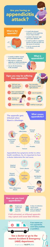 Preventing Appendicitis: Tips And Recommendations - Ask The Nurse Expert