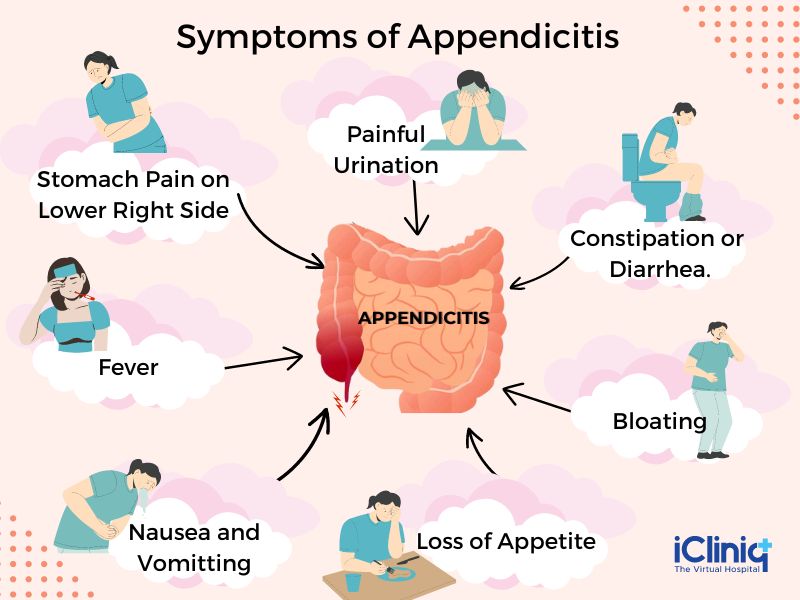 Risk Factors And Precautions For Appendicitis - Ask The Nurse Expert