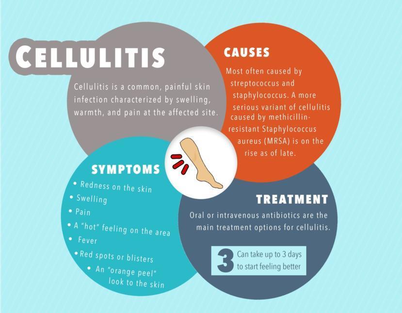 Risk Factors And Precautions For Cellulitis - Ask The Nurse Expert
