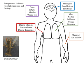 Risk Factors And Precautions For Paragonimiasis - Ask The Nurse Expert