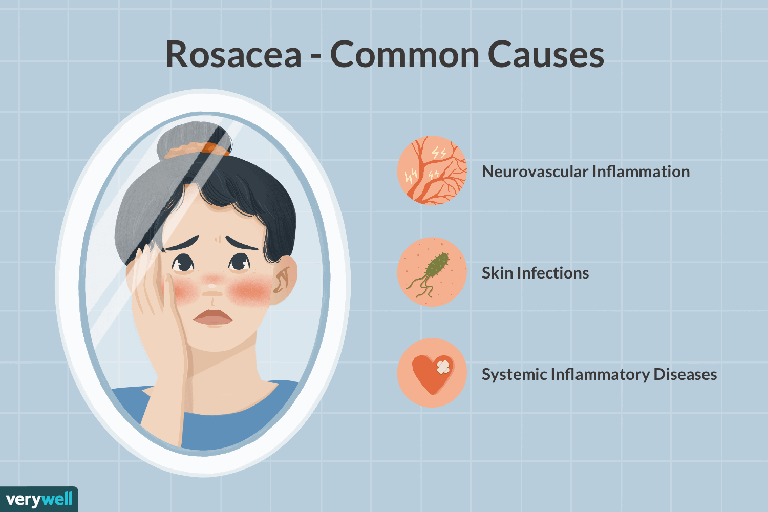 Risk Factors And Precautions For Rosacea - Ask The Nurse Expert