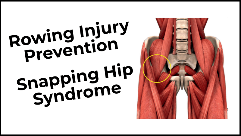 Risk Factors And Precautions For Snapping Hip Syndrome - Ask The Nurse ...