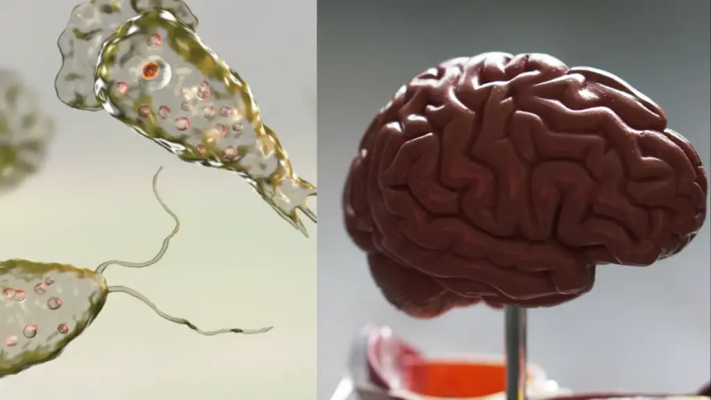 The Deadly Threat Of Brain-Eating Amoeba - Ask The Nurse Expert