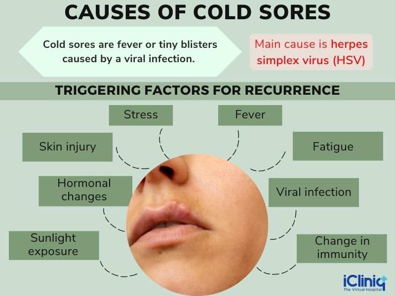 Understanding The Causes Of Cold Sores - Ask The Nurse Expert