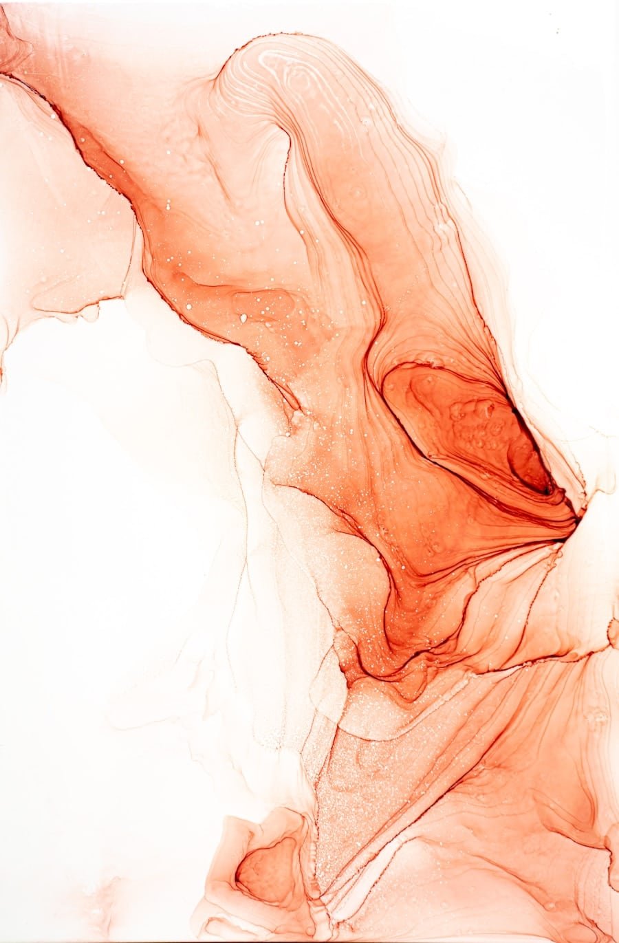 Enlarged Prostate Understanding The Risks And Complications Ask The 5618