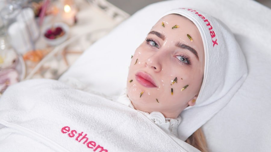 Severe Acne in Young Men